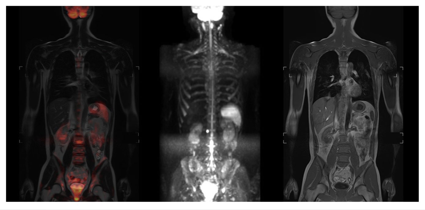 DWIBS（ドゥイブス）® | EXクリニック 大阪梅田院 | 梅田駅3分